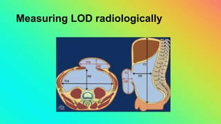 Loss of domain in large ventral hernias.pptx