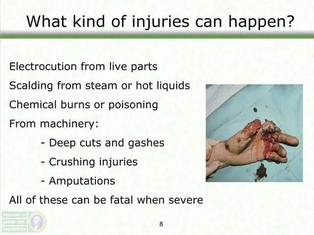 Loto training | PPT | First Aid | Injuries