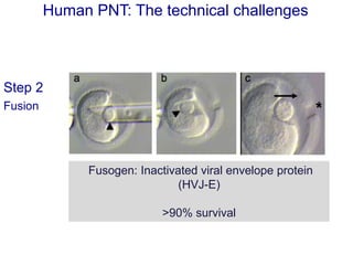 Louise Hyslop-Diagnóstico prenatal no invasivo y diagnóstico genético ...