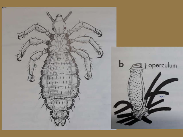 Louse and cyclops | PPTX | Infectious Diseases | Diseases and Conditions