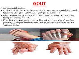 GOUT | PPTX | Hormonal Disorders | Endocrine and Metabolic Diseases