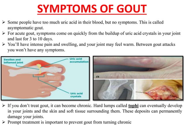 GOUT | PPTX | Hormonal Disorders | Endocrine and Metabolic Diseases
