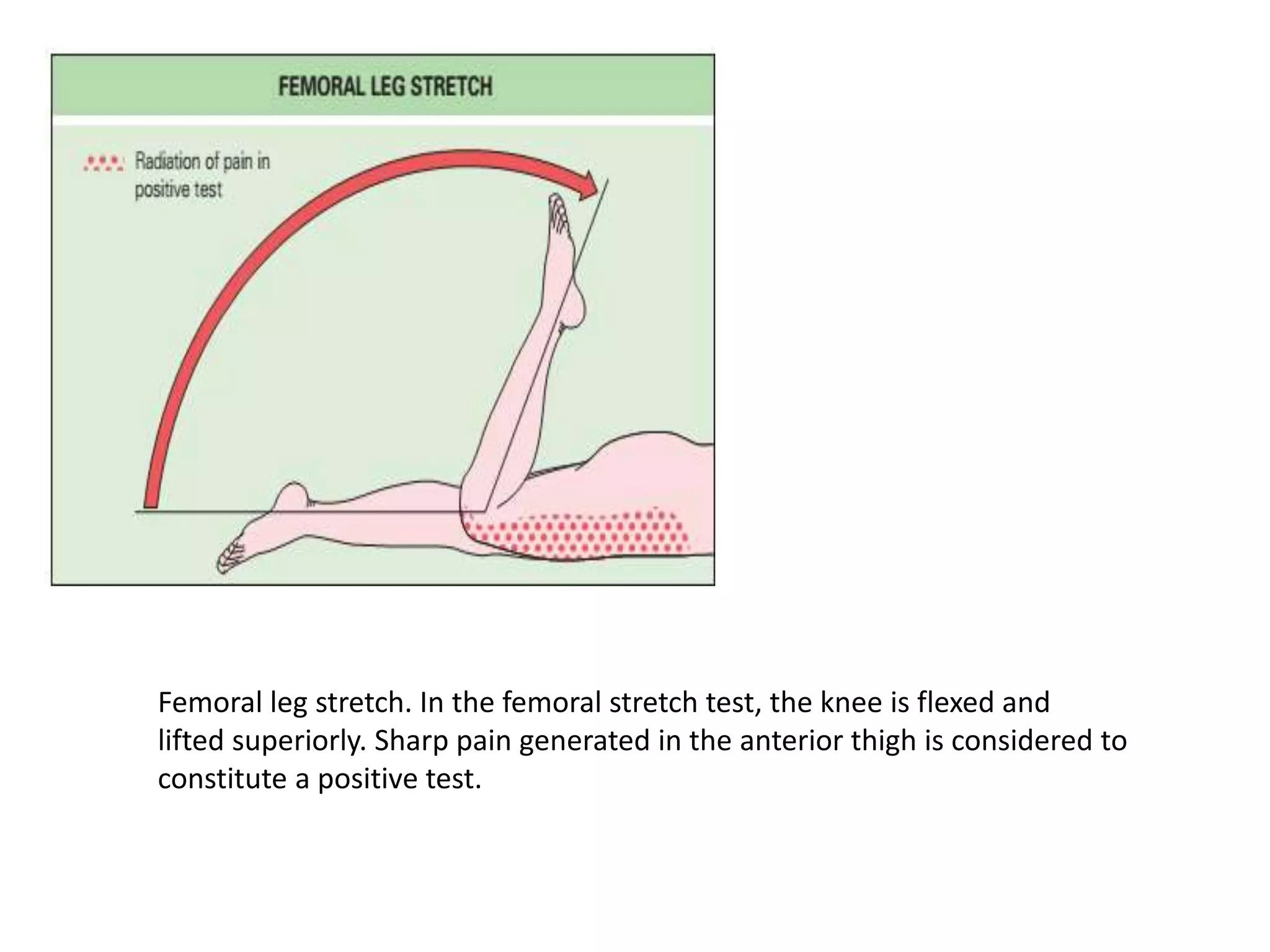 Low back pain | PPTX