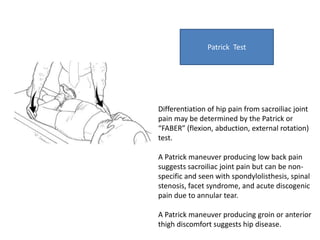 Low back pain | PPTX