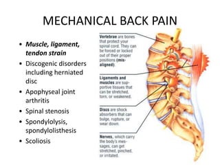 Low back pain | PPTX