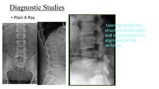 Low_back_pain__overview in orthopaedics. | PPTX