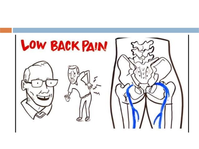 Low back pain & ergonomics | PPTX