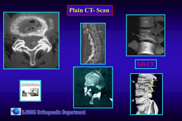 Low Back Pain abc A review of anatomy and treatment options for low ...