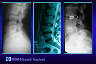 Low Back Pain abc A review of anatomy and treatment options for low ...