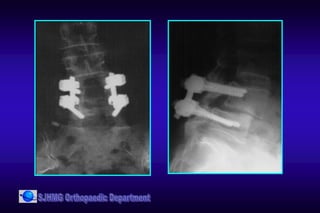 Low Back Pain abc A review of anatomy and treatment options for low ...