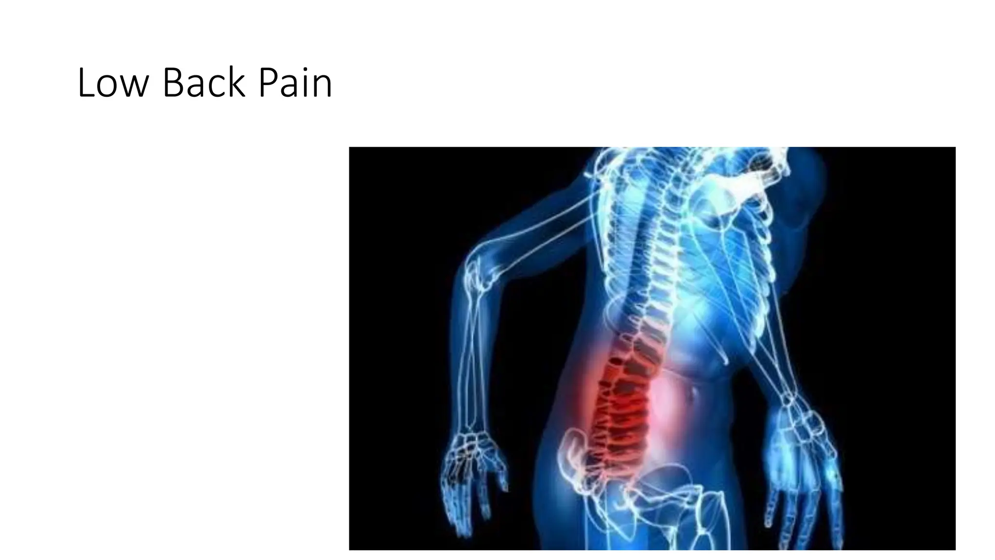 Low Back Pain lecture with associated causes | PPTX