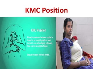 Low birth weight | PPTX