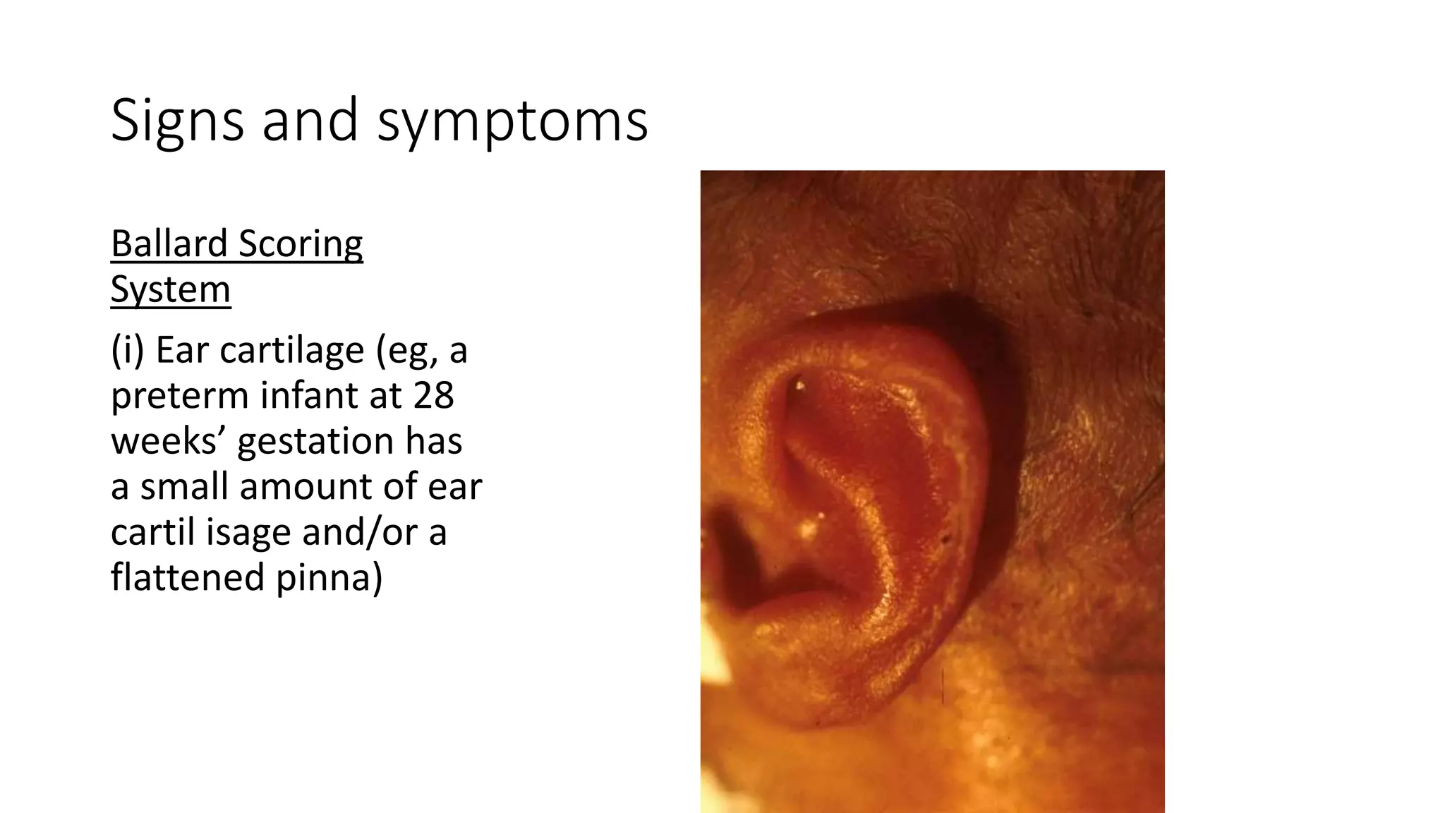 Low birth Weight and Prematurity.pptx