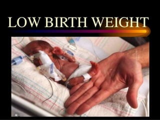 Low Birth Weight Baby-PPT.pptx