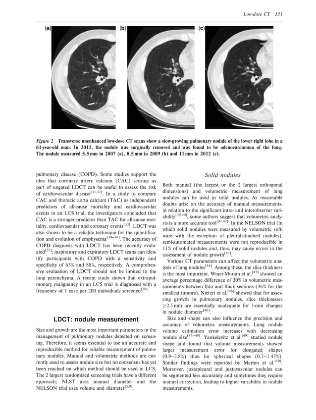 low dose CT.pdf | Lung and Respiratory Health | Diseases and Conditions