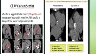 Management-Severe Aortic stenosis with Low Transvalvular Gradient and ...