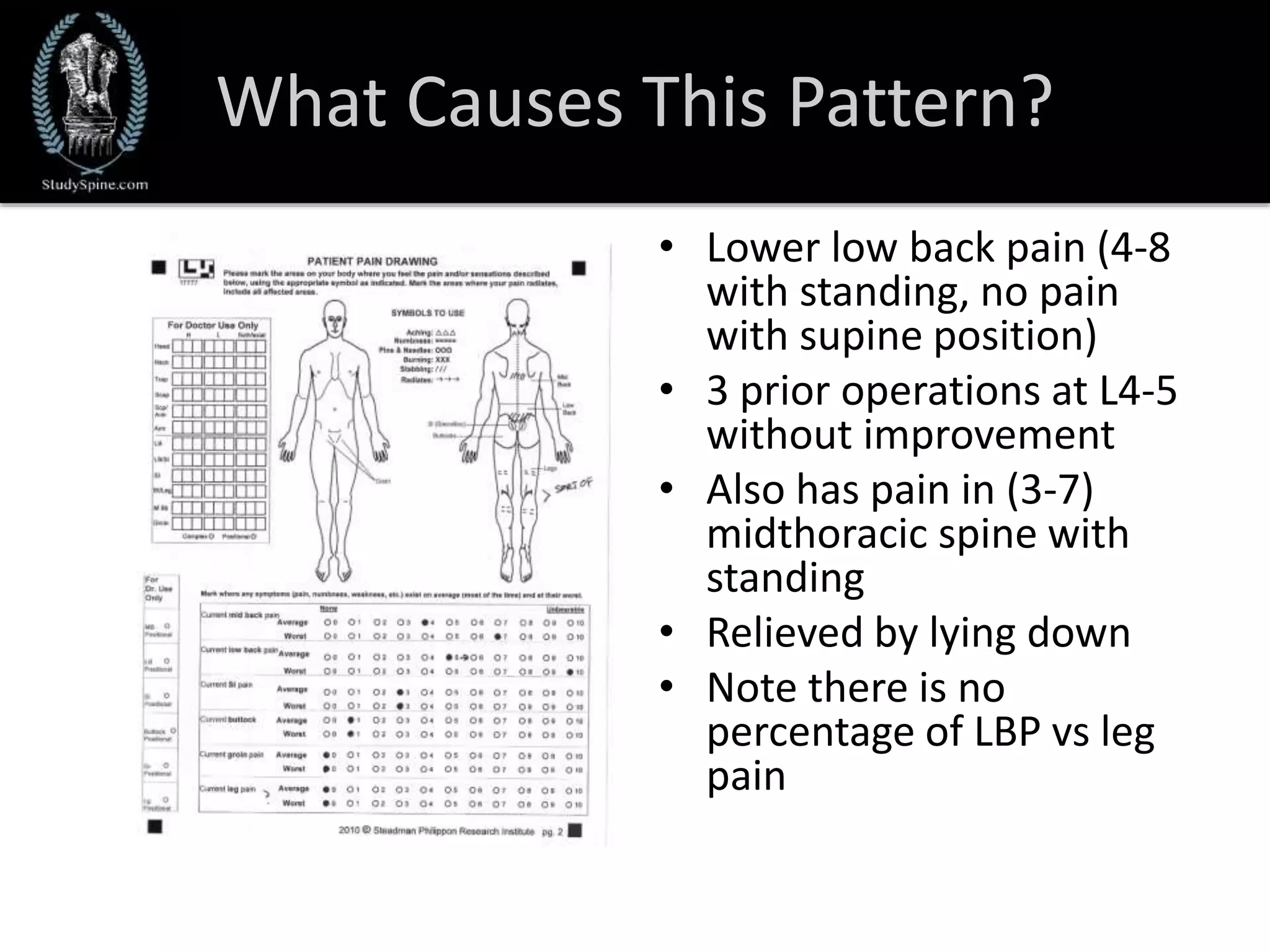 What causes this pattern? | PPTX