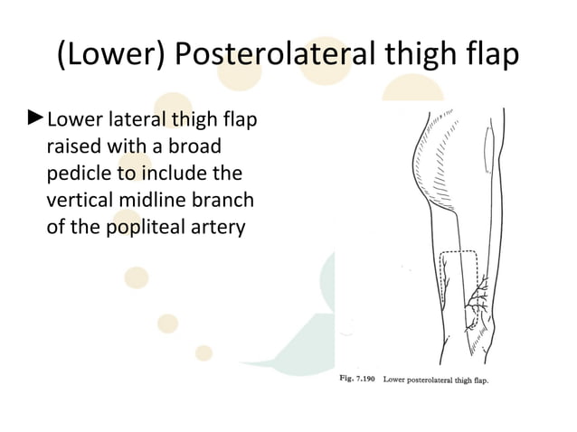Lower limb-flaps | PPT