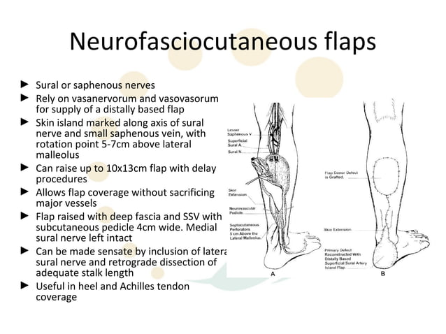 Lower limb-flaps | PPT