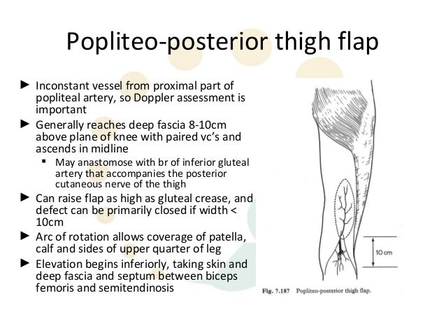 Lower limb-flaps