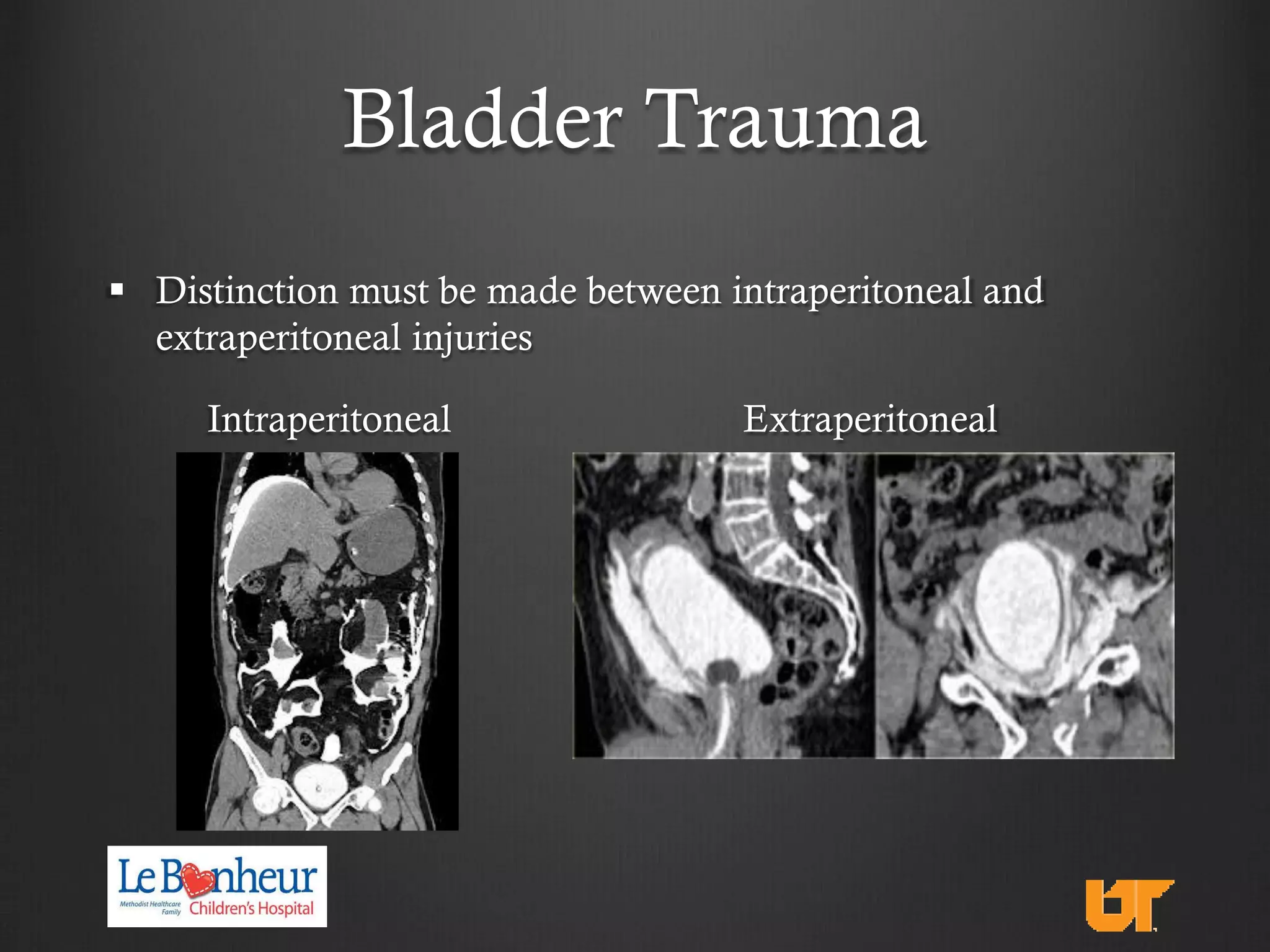 Lower urinary-tract-trauma-in-the-setting-of-pelvic-fractures | PDF