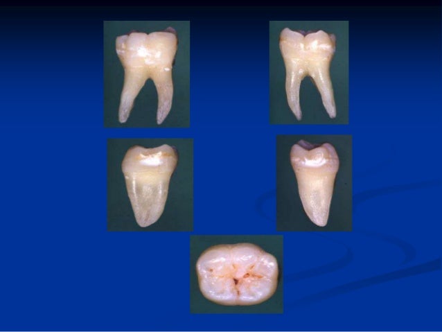 Lower First Molar
