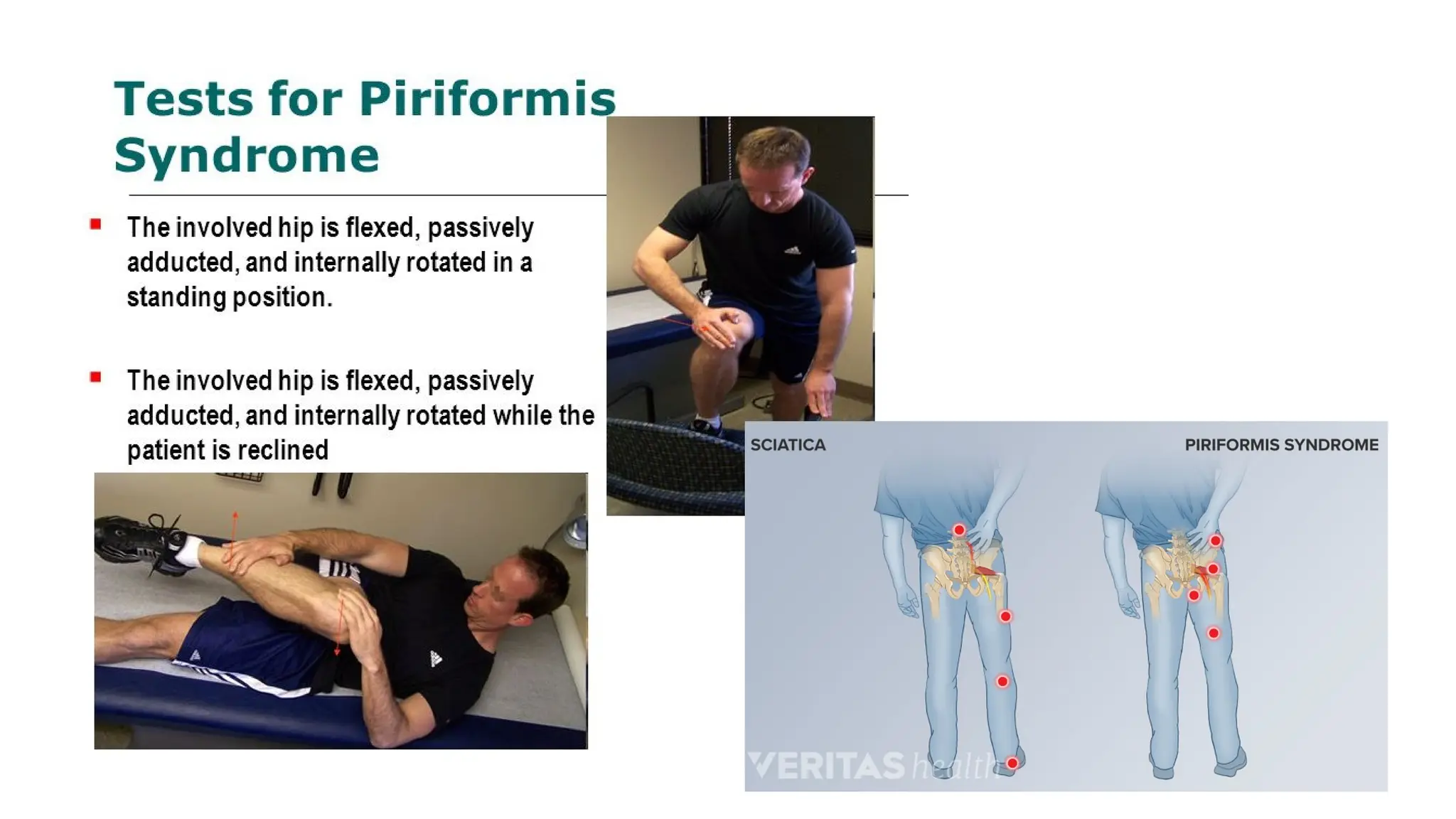 lower back pain tests for patients with back pain.pptx