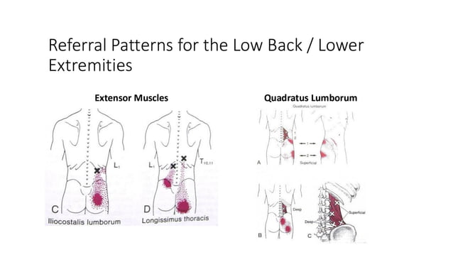 lower back pain tests for patients with back pain.pptx