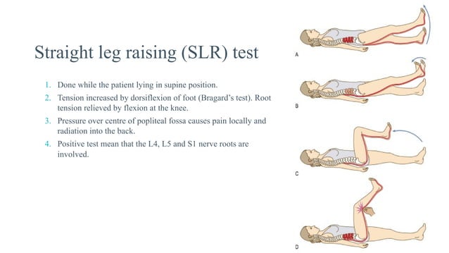 lower back pain tests for patients with back pain.pptx