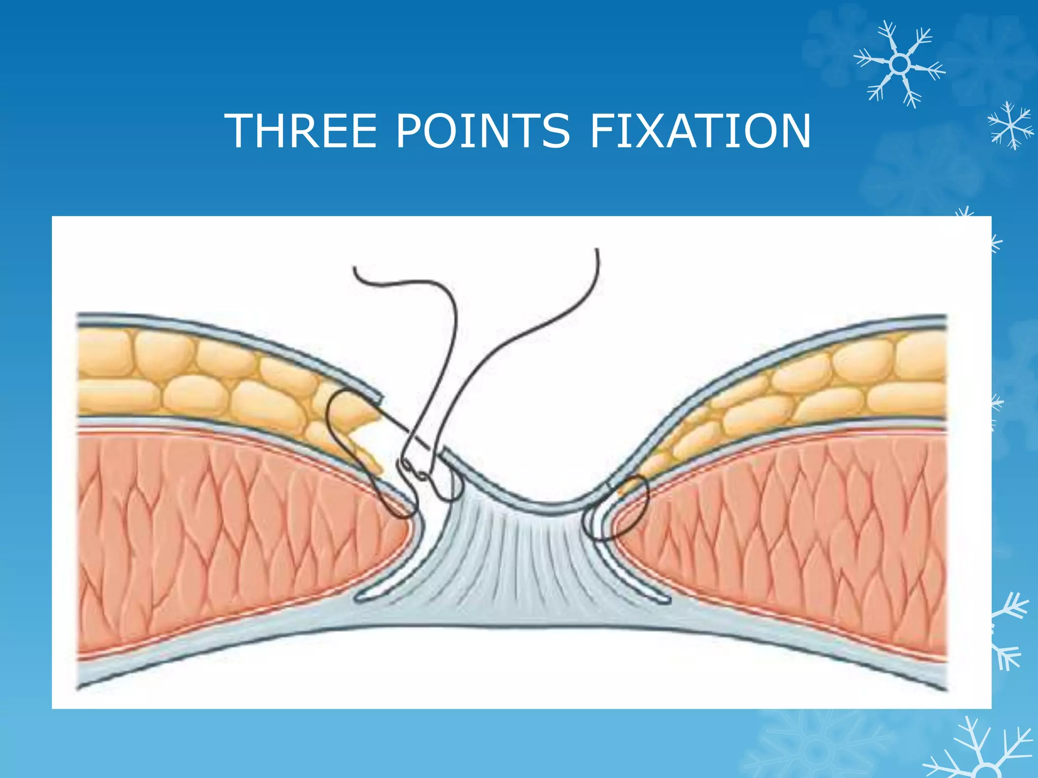 Lower body lifts | PPT