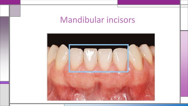 Mandibular central & lateral incisors