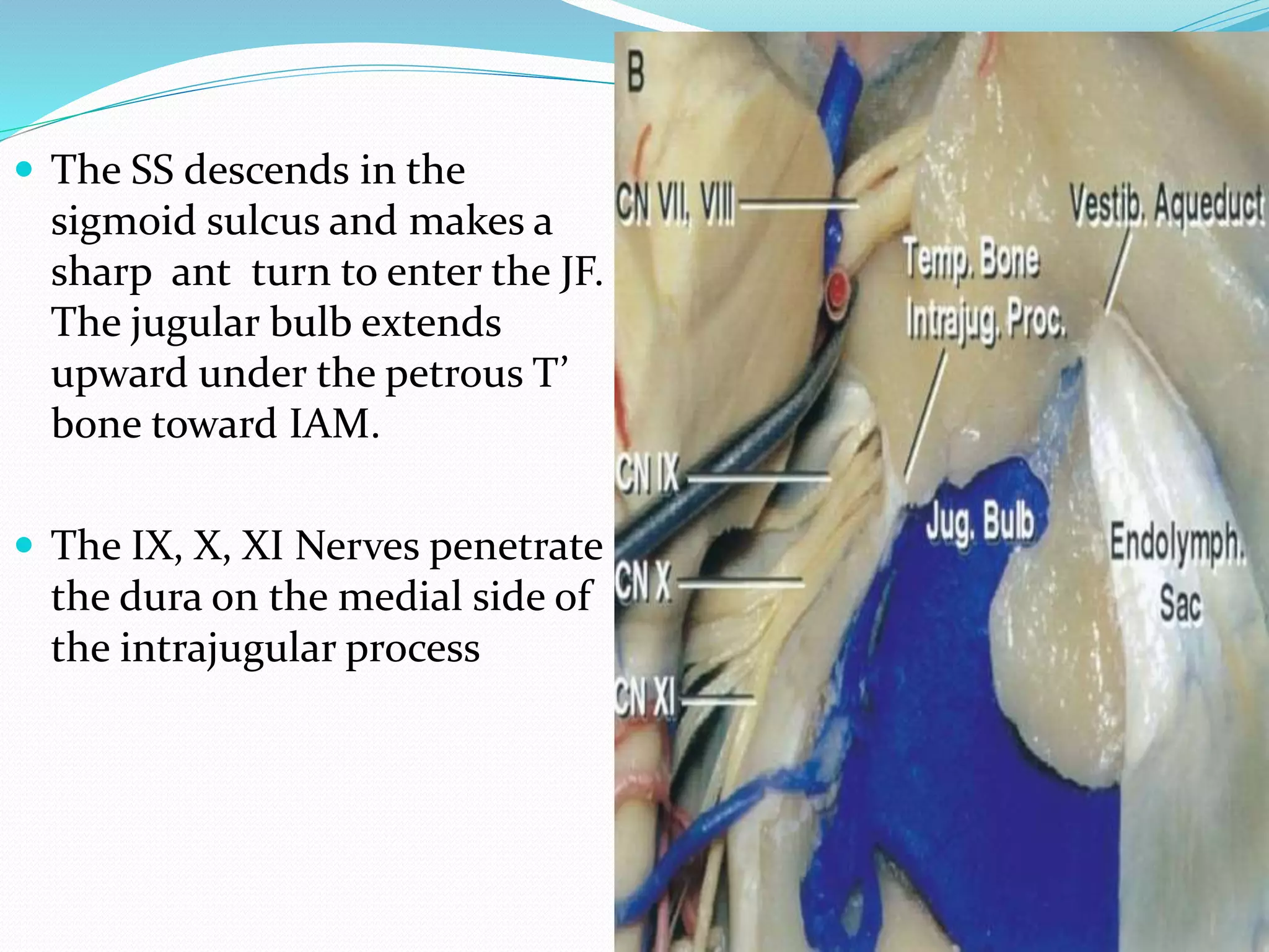 Lower cranial nerves ajay | PPTX