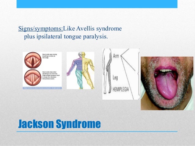 Disorder of lower cranial nerves