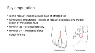Lower extremity amputation | PPT