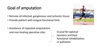 Lower extremity amputation | PPT | Physical Therapy | Wellness