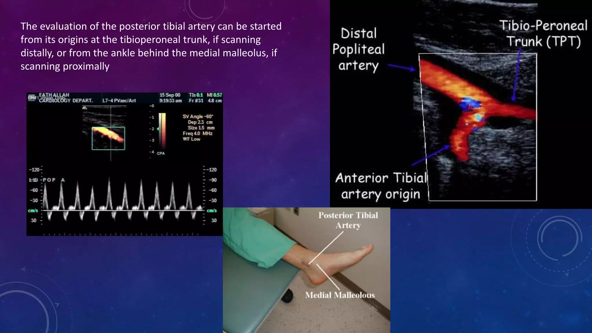 lower extremity doppler ultrasound.pptx