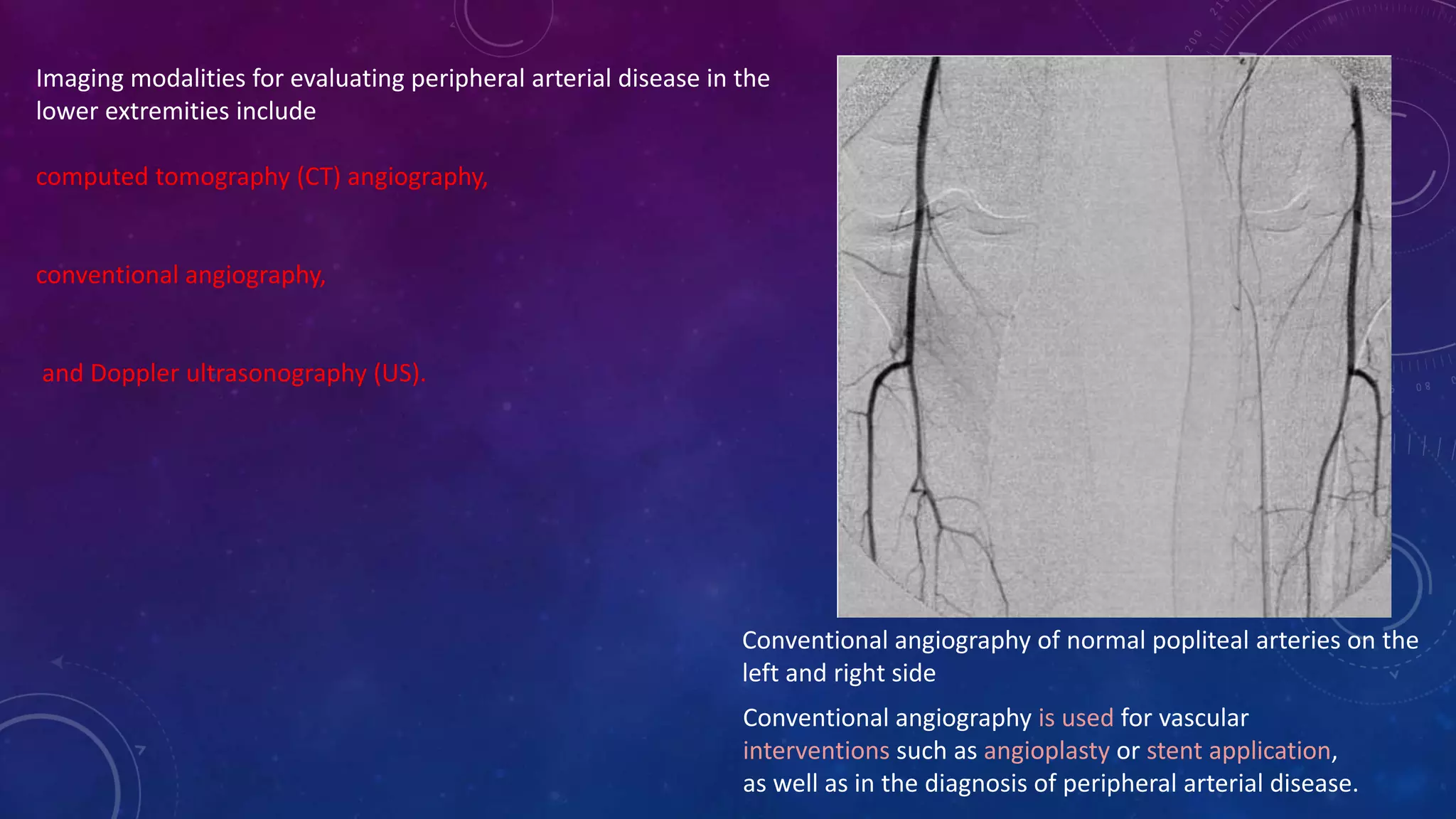 lower extremity doppler ultrasound.pptx