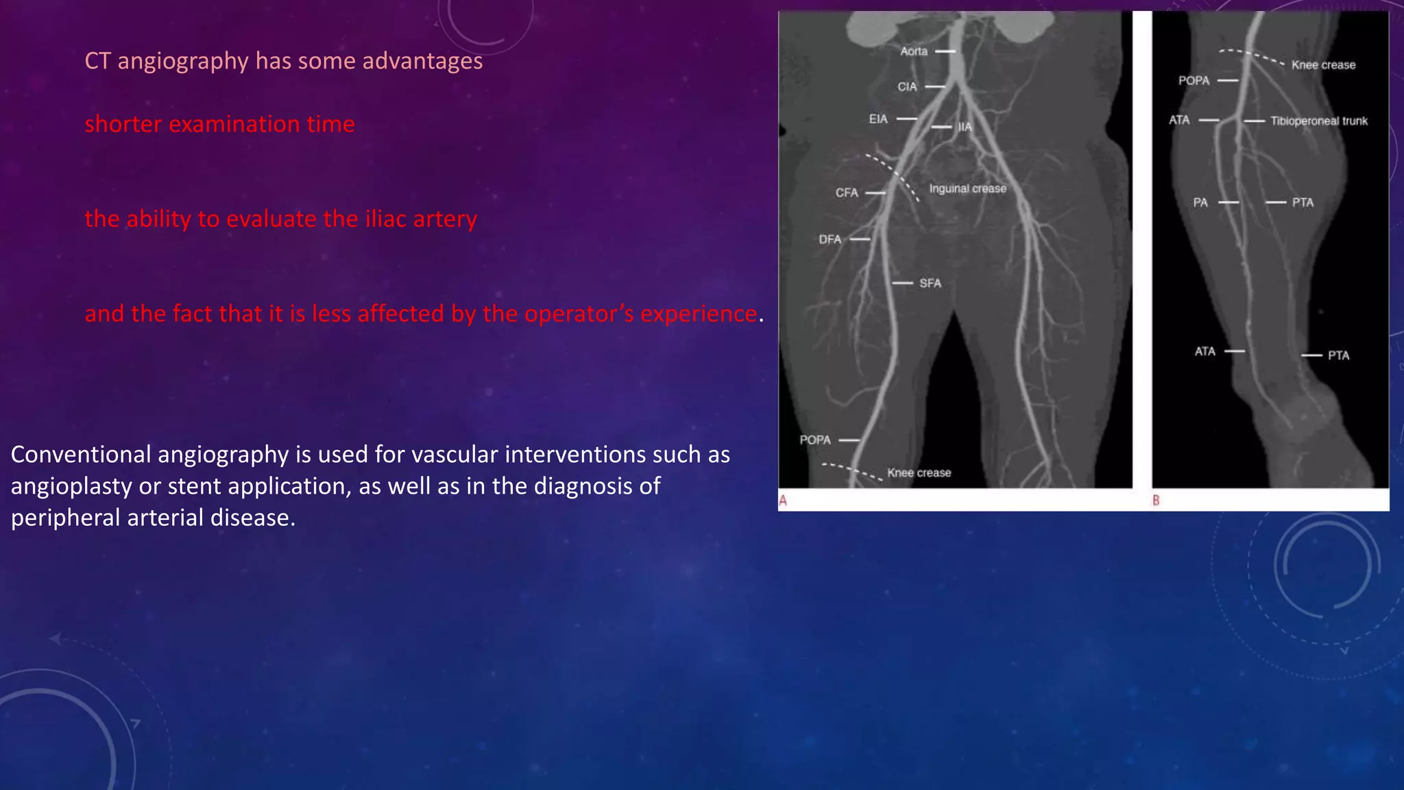 lower extremity doppler ultrasound.pptx