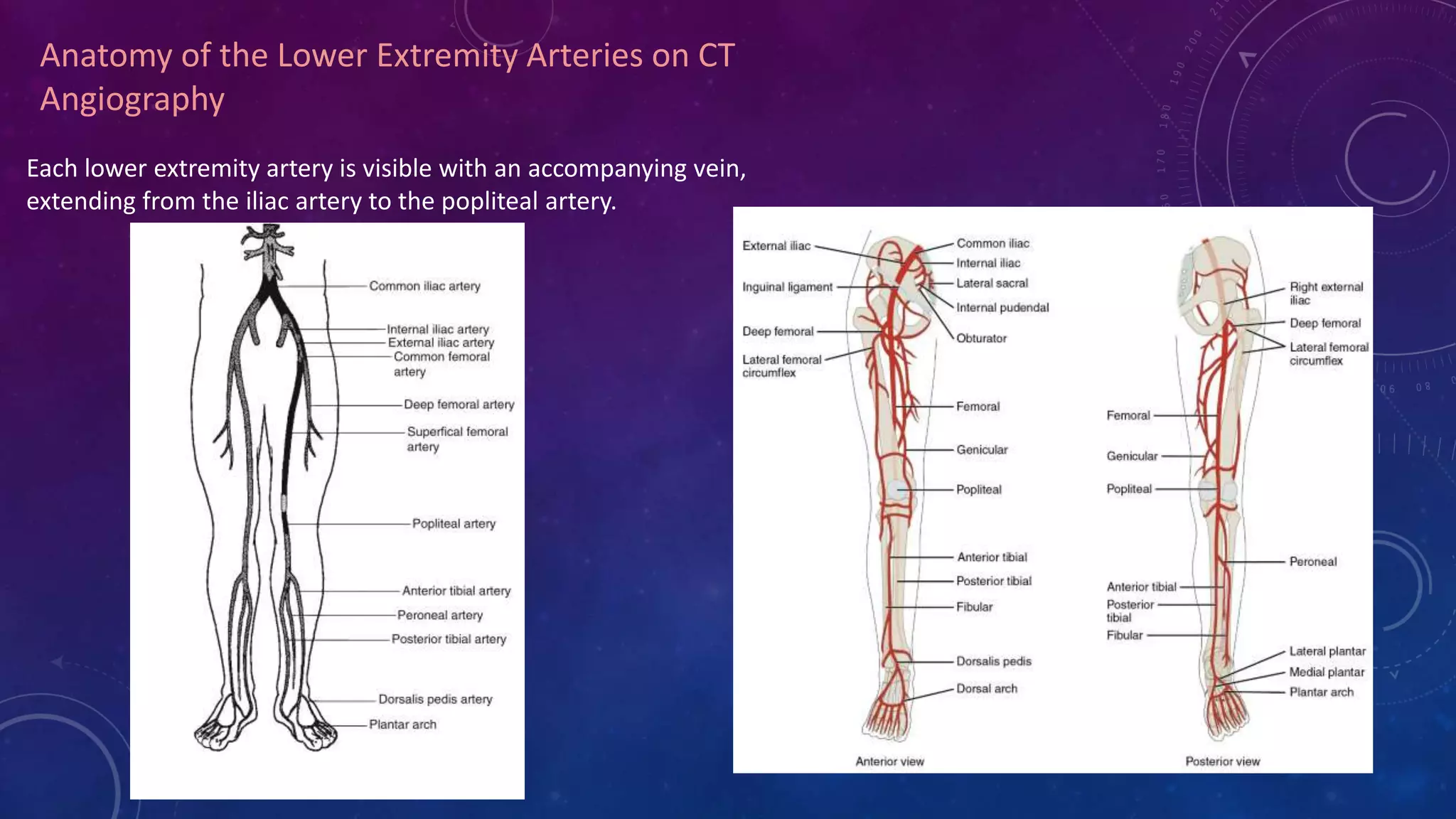 lower extremity doppler ultrasound.pptx