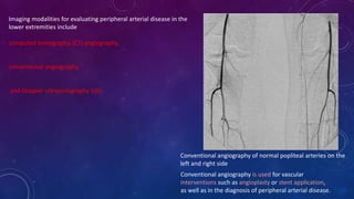 lower extremity doppler ultrasound.pptx