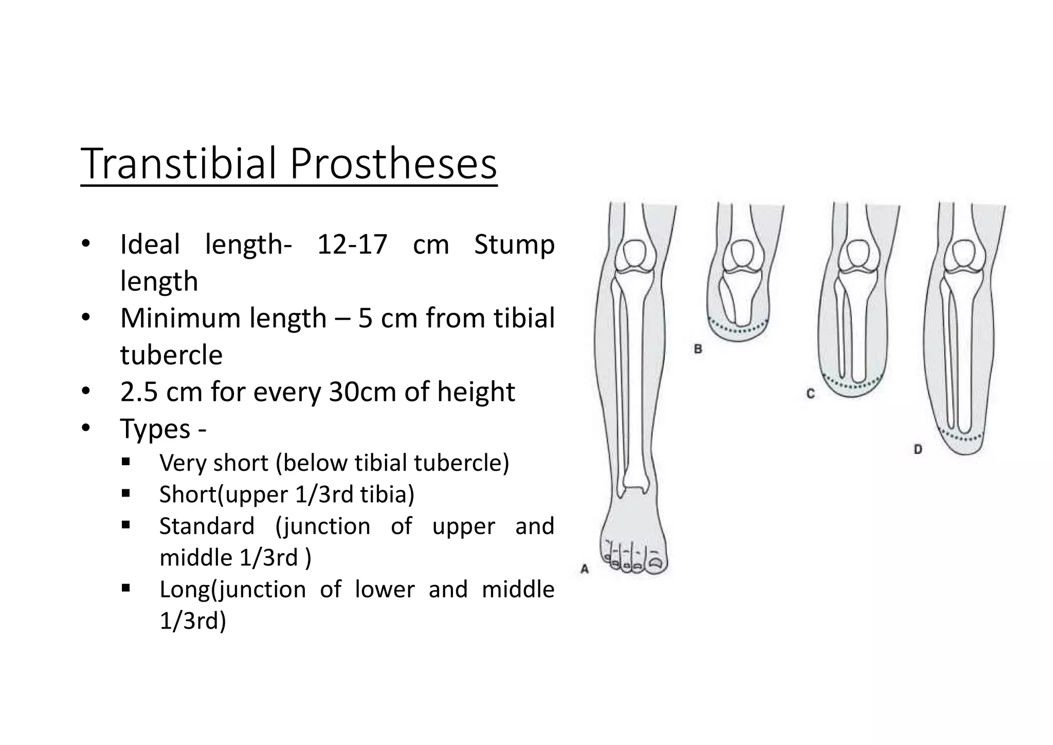 Lower extremity prostheses | PDF