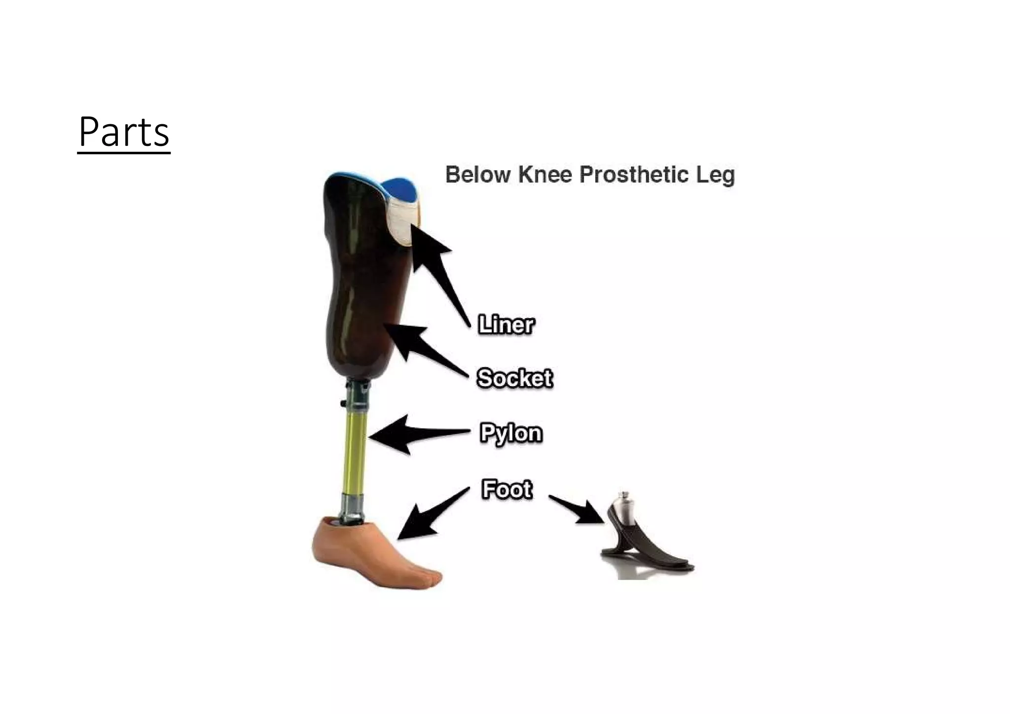 Lower extremity prostheses | PDF