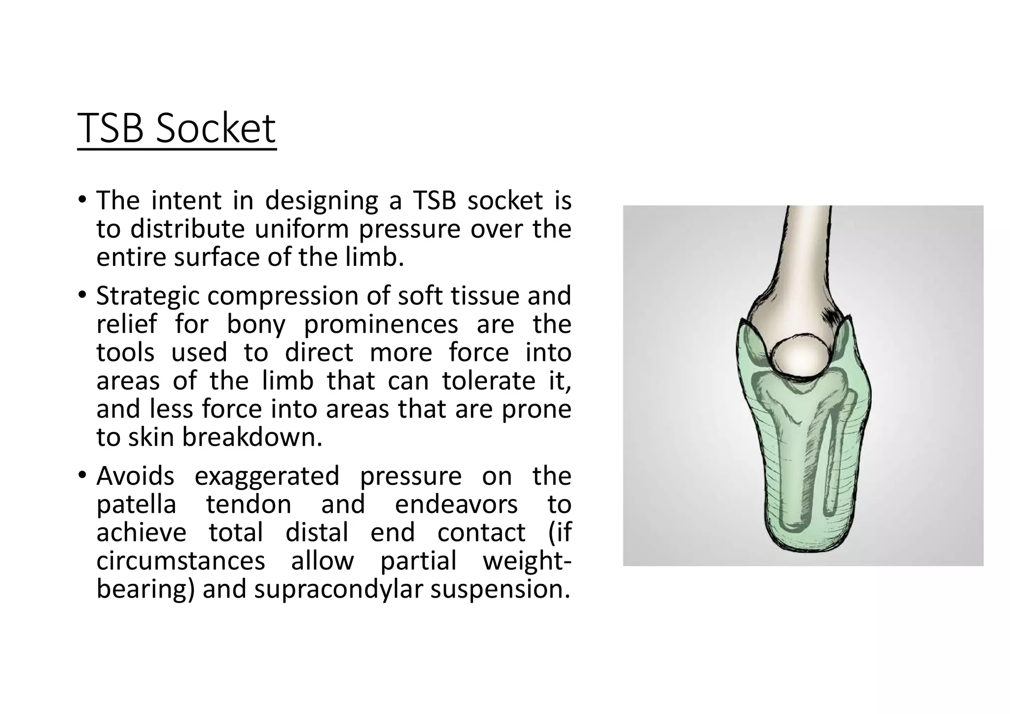 Lower extremity prostheses | PDF