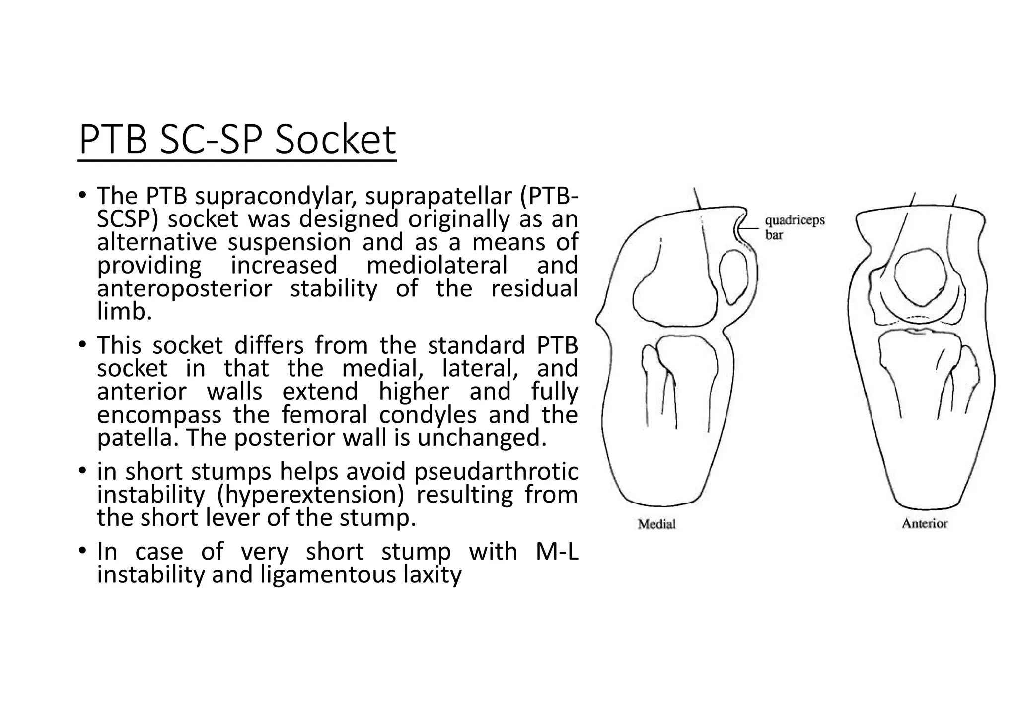 Lower extremity prostheses | PDF