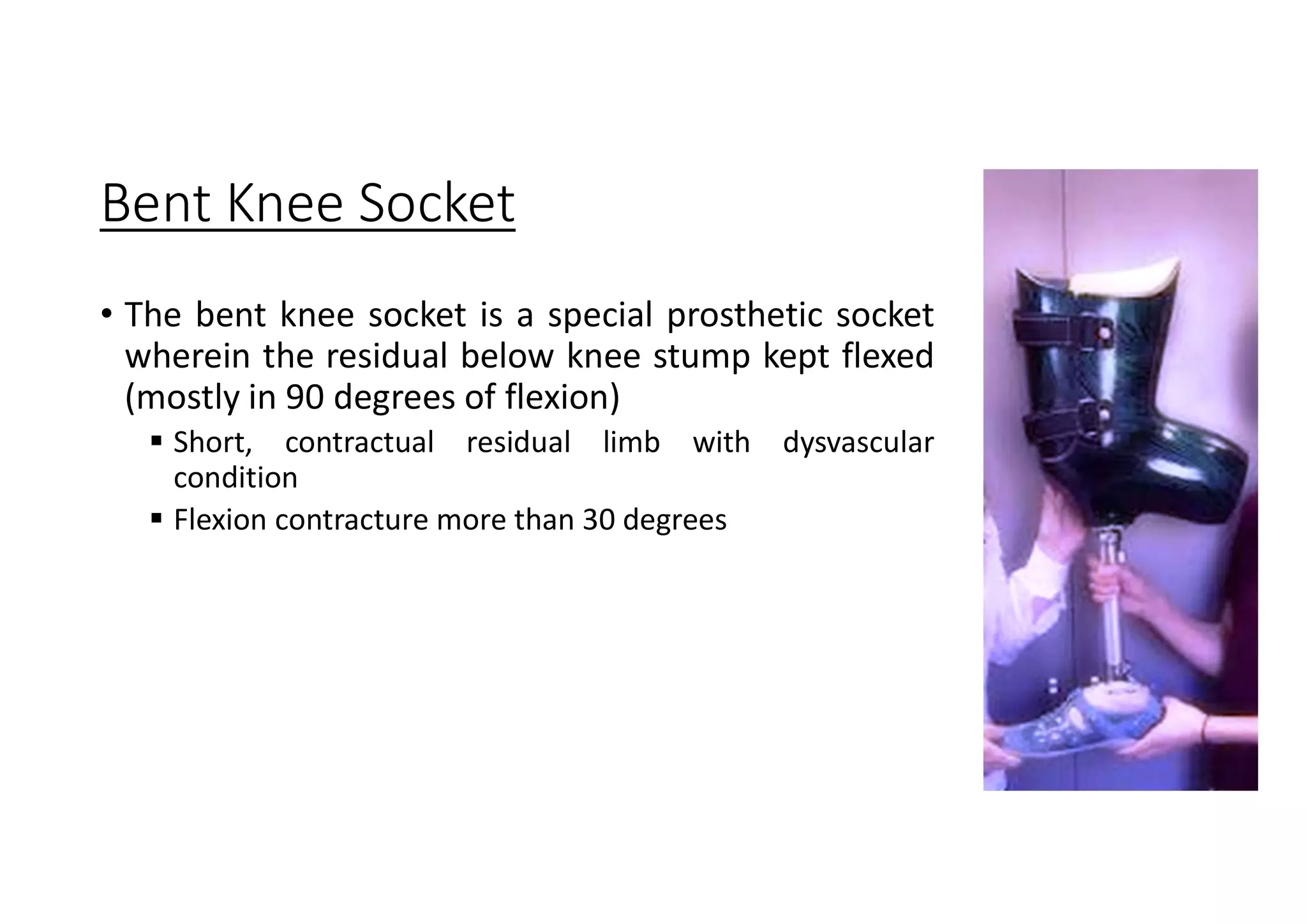Lower extremity prostheses | PDF