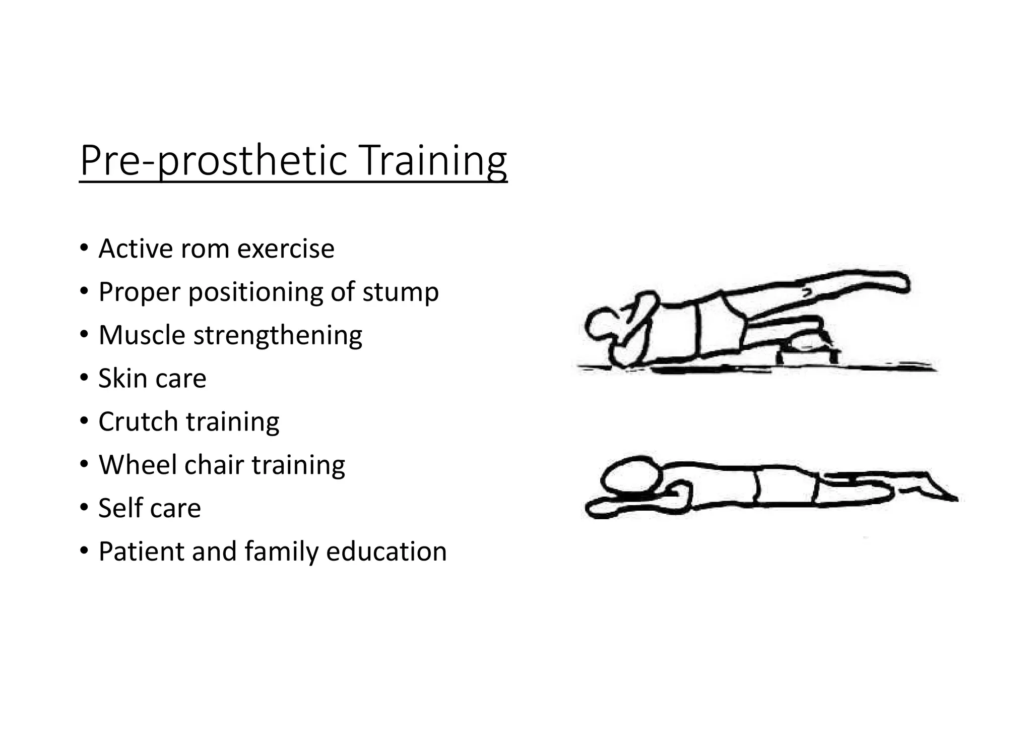 Lower extremity prostheses | PDF