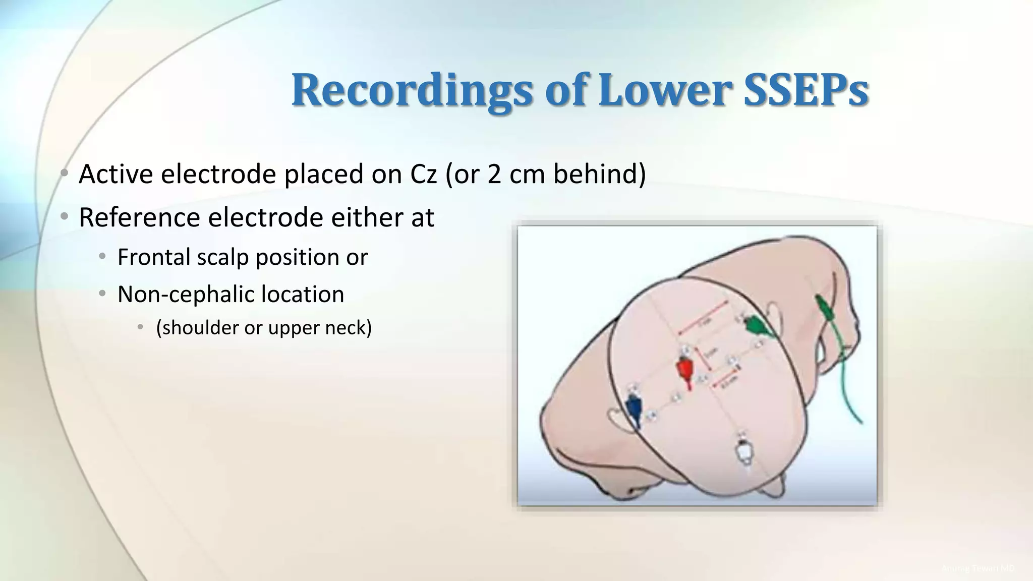 Lower Extremity Somatosensory Evoked Potentials (lower SSEP) | PPTX