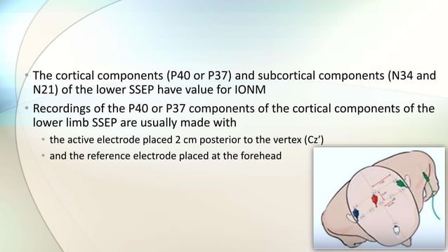 Lower Extremity Somatosensory Evoked Potentials (lower SSEP) | PPTX