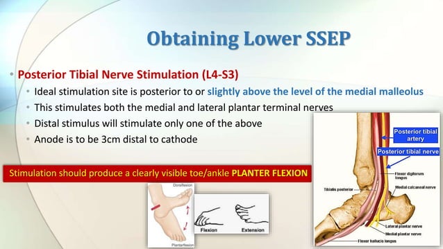 Lower Extremity Somatosensory Evoked Potentials (lower SSEP) | PPT
