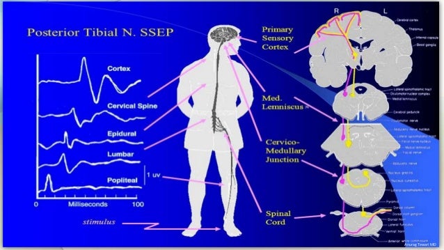 Lower Extremity Somatosensory Evoked Potentials (lower SSEP)